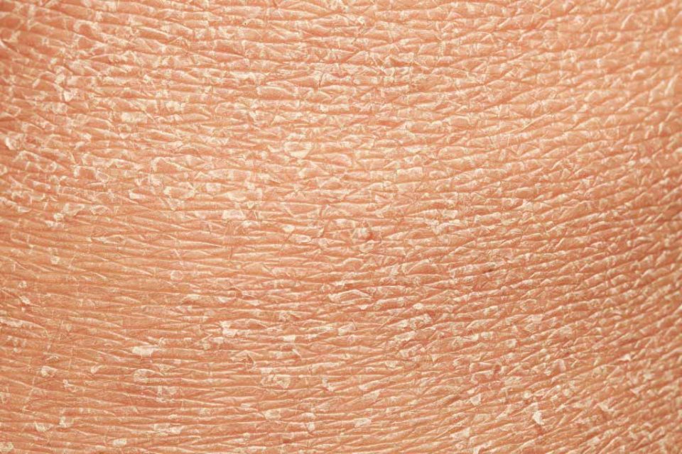 Why Do I Have Skin Problems? | Nutrients For Healthy Skin