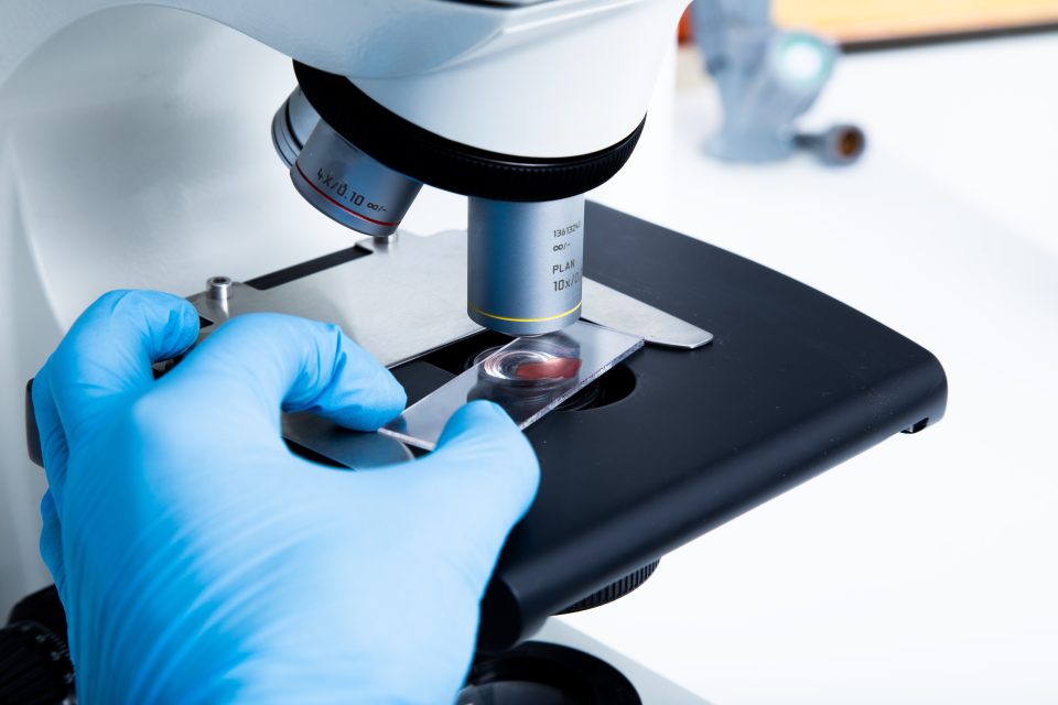 Understanding Functional Blood Chemistry | Functional Medicine Nutrition