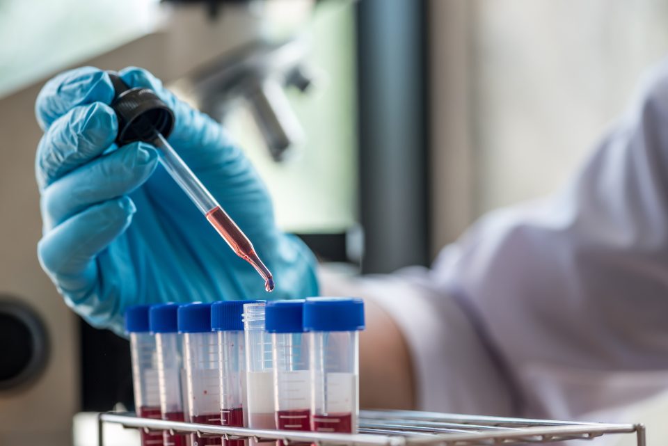 Understanding Functional Blood Chemistry | Functional Medicine Nutrition
