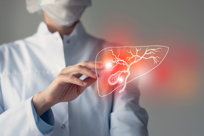 How To Improve Liver & Gall Bladder Health | Functional Medicine Tips