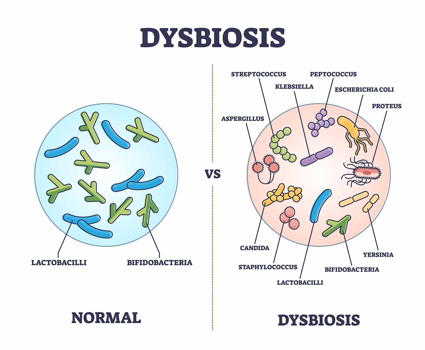 How To Prevent Dysbiosis & Heal Your Gut Microbiome With Functional ...