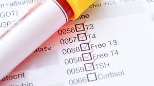 The Ultimate Guide To Functional Tests