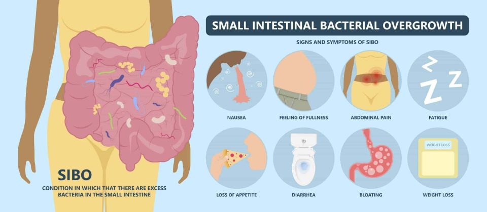 How To Fix Small Intestinal Bacterial Overgrowth (SIBO) With Nutrition
